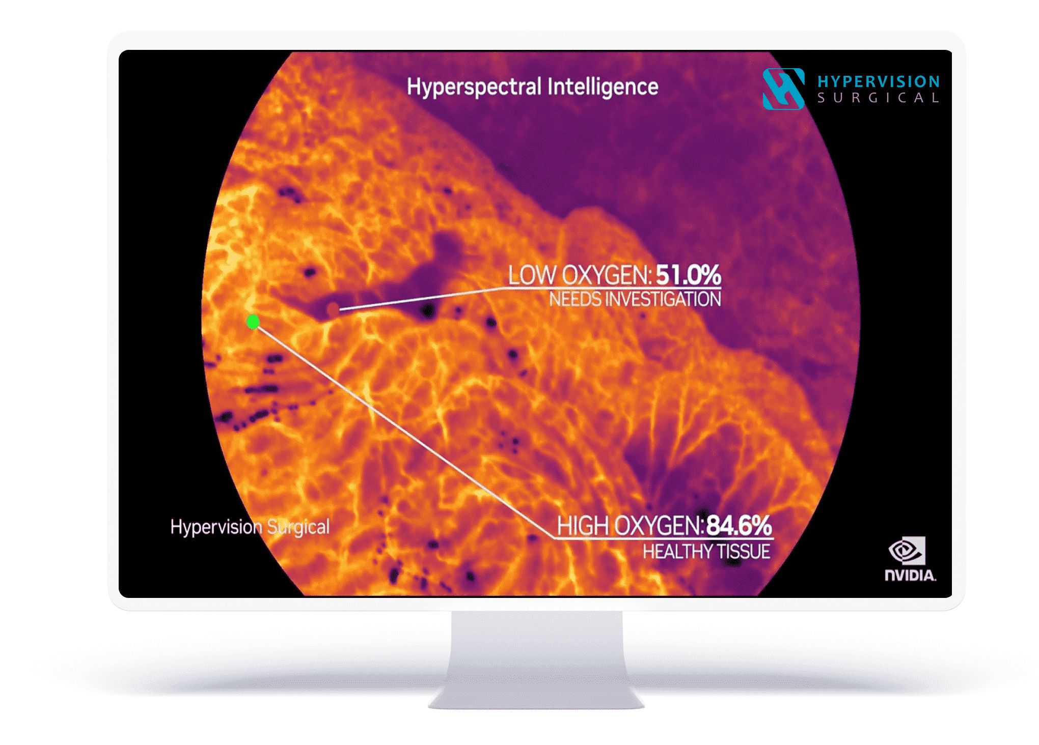 Heran Partners | Portfolio